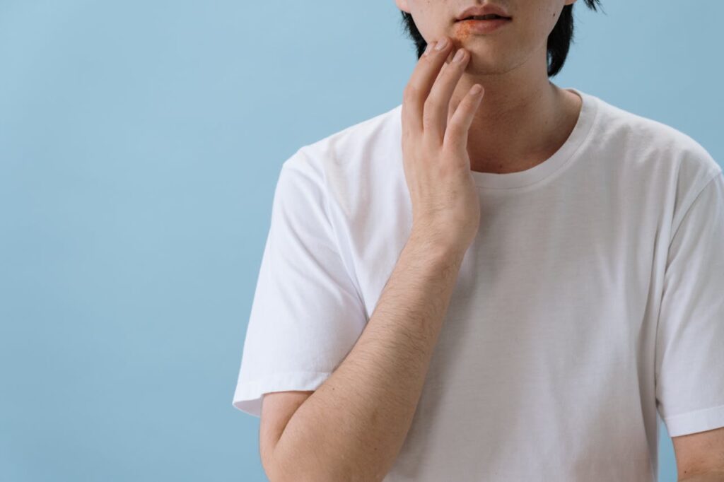 Drugs and Skin Sores: Signs, Causes, and When to Seek Help ...